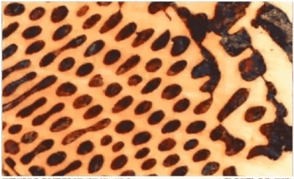 8 Common Microstructures of Metal and Alloy - Meetyou Carbide